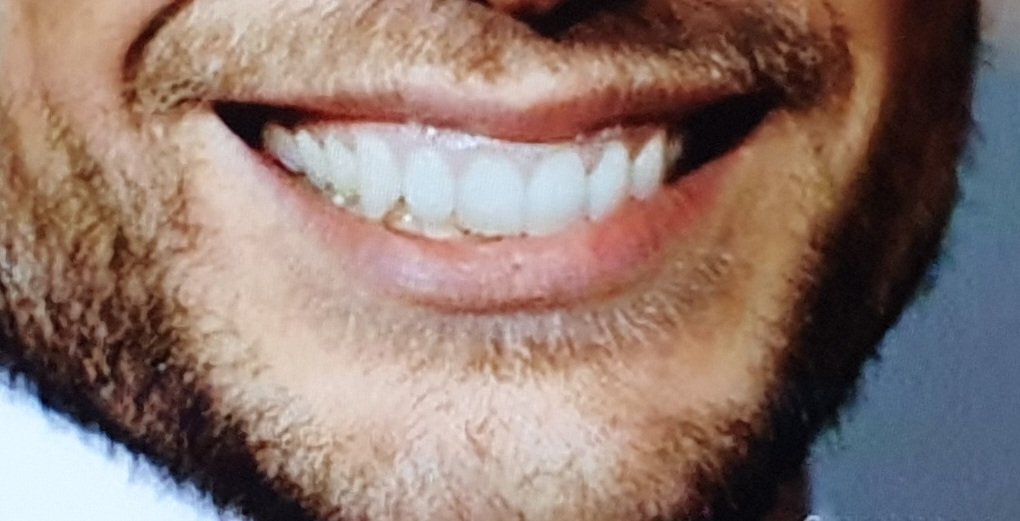 Solve FAMOUS SMILES - GUESS jigsaw puzzle online with 18 pieces
