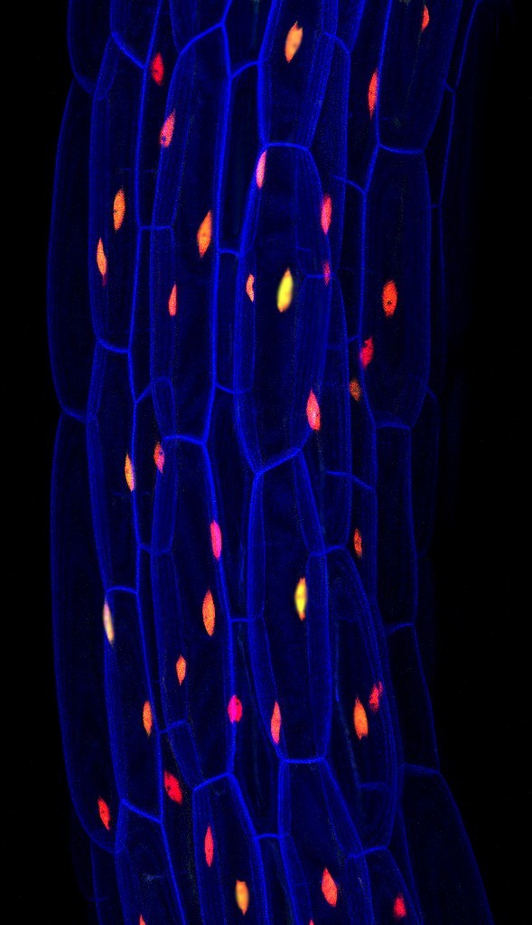 Solve Confocal micrograph of an Arabidopsis thaliana (thale cress ...
